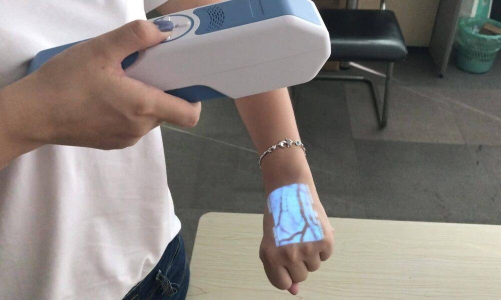 Vein Finder Technology is Getting A Trend - Lemony Blog